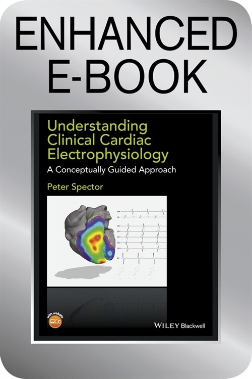 [eBook Code] Understanding Clinical Cardiac Electrophysiology (eBook Code, 1st) | Peter Spector ...